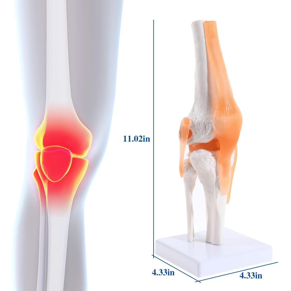 Knee Joint Model With Flexible Ligaments Life Size For Anatomical